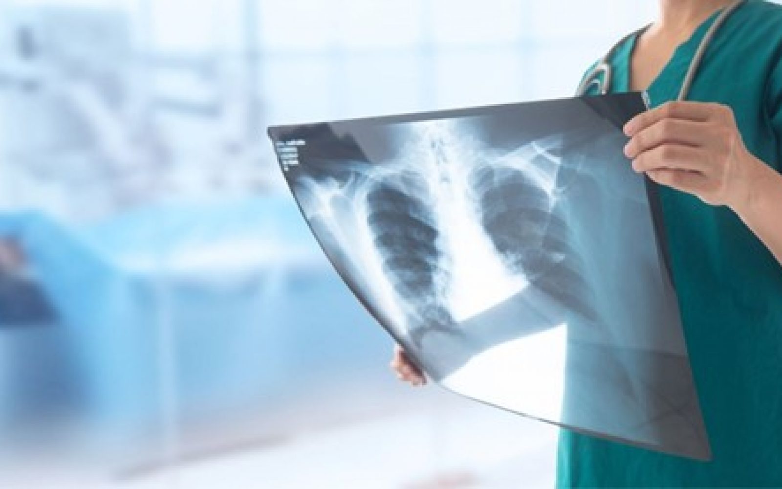 Yapay zeka tek röntgenle kalp krizini tahmin ediyor - Herkese Bilim ...